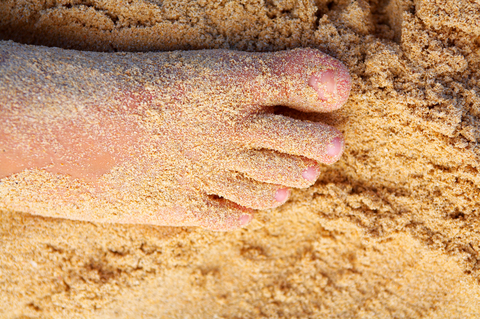 Dry, Cracked Toenails أظافر جافة ومتشققة | Dubai Podiatry Centre
