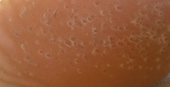 Smelly,sweaty, pitted feet? – Dubai Podiatry Centre