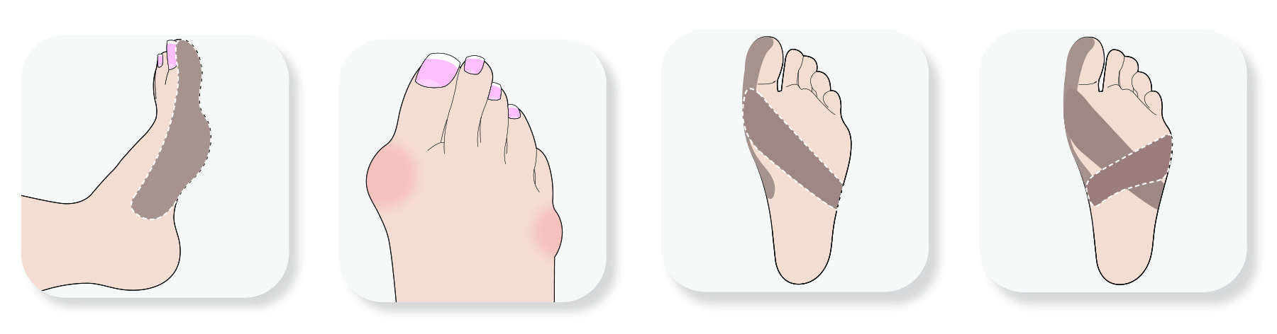 High heels and feet | Dubai Podiatry Centre