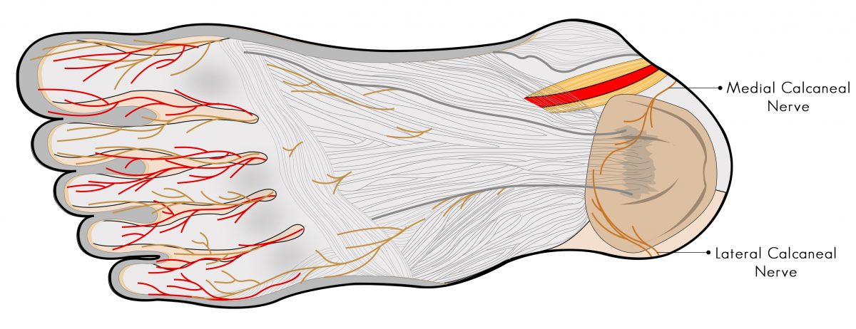 Calcaneal Nerve Causing Heel Pain | Dubai Podiatry Centre