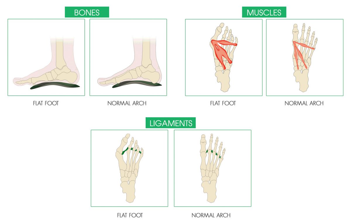3 STEPS | Dubai Podiatry Centre