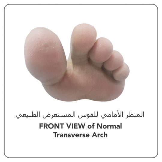 Transverse Arch قوس العرضي – Dubai Podiatry Centre