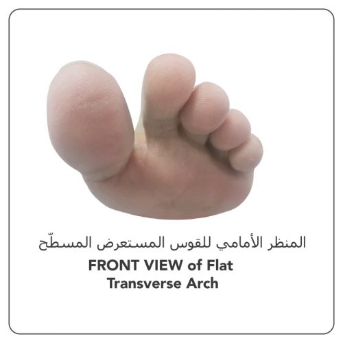 Transverse Arch قوس العرضي – Dubai Podiatry Centre