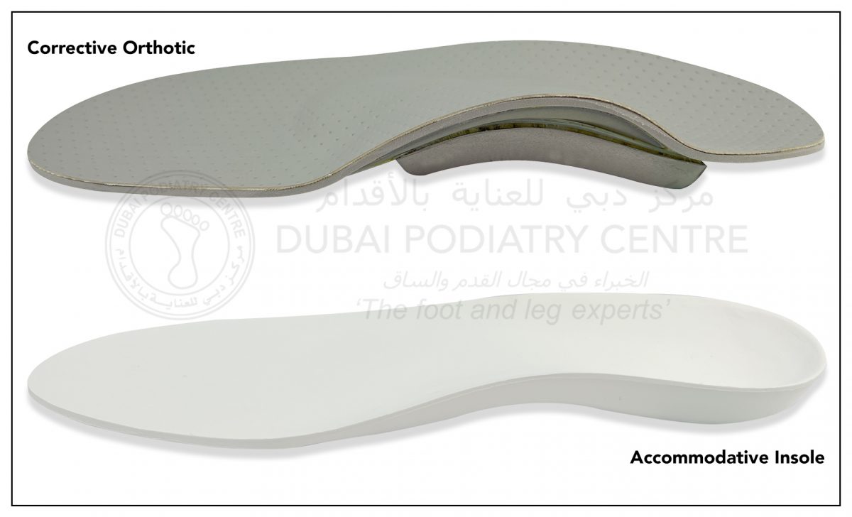 Difference between an Accommodative Insole and a Corrective Orthotic ...